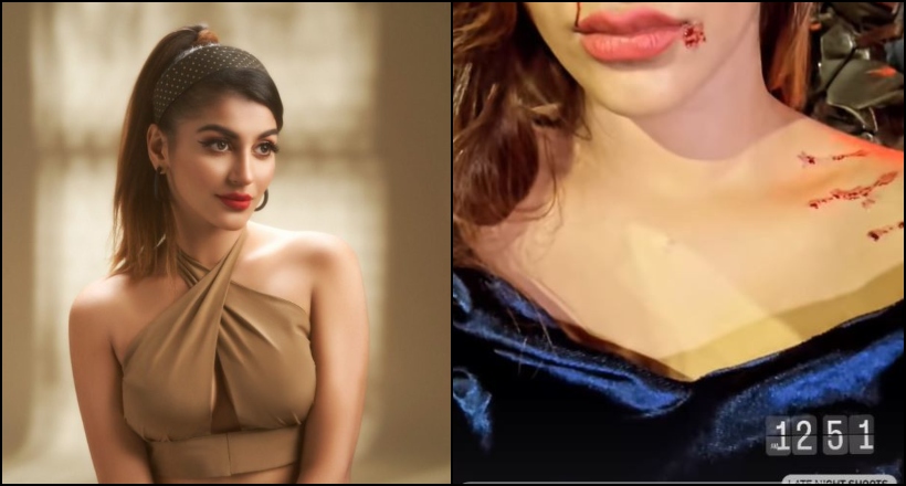 உங்களுக்கு என்ன ஆச்சு?…. முகத்தில் ரத்த காயங்களுடன் ரசிகர்களுக்கு ஷாக் கொடுத்த நடிகை யாஷிகா ...